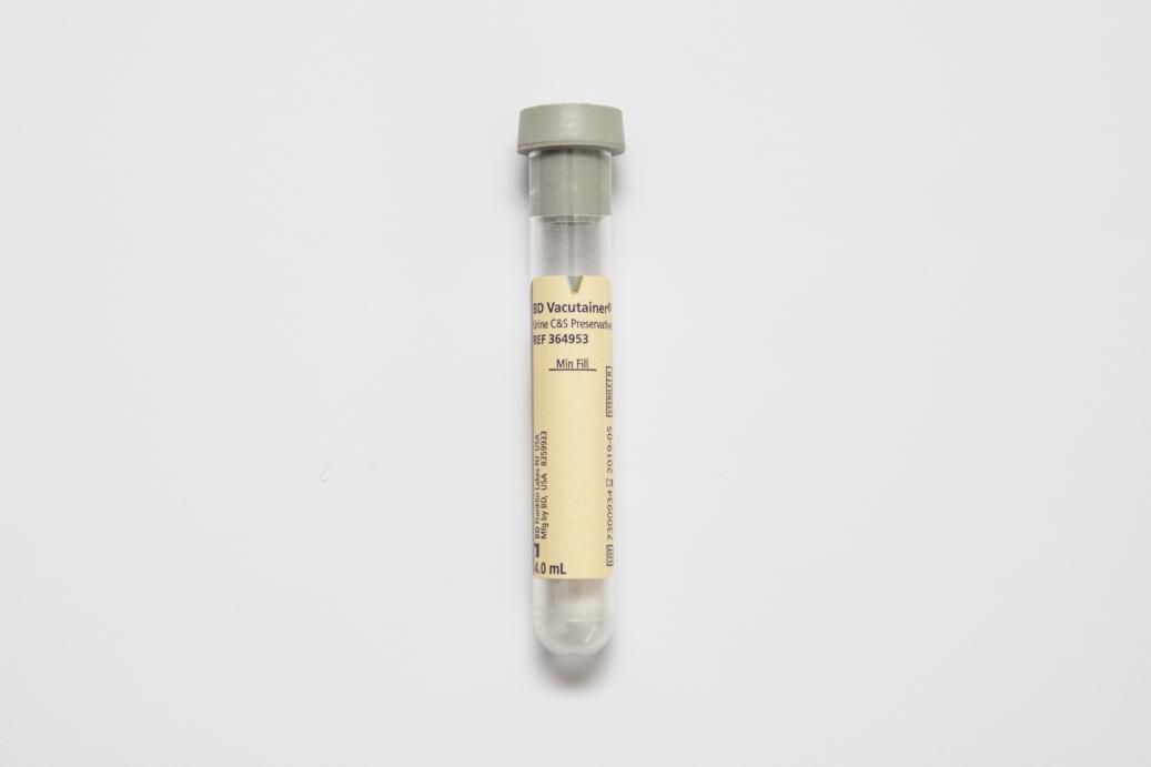 Aerobic Culture Urine Clean Catch MLabs Aerobic Culture Urine Clean Catch MLabs