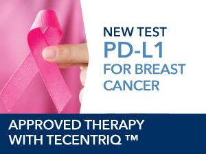 news-thumbnail-pdl1-testing-breast-cancer.jpg | MLabs